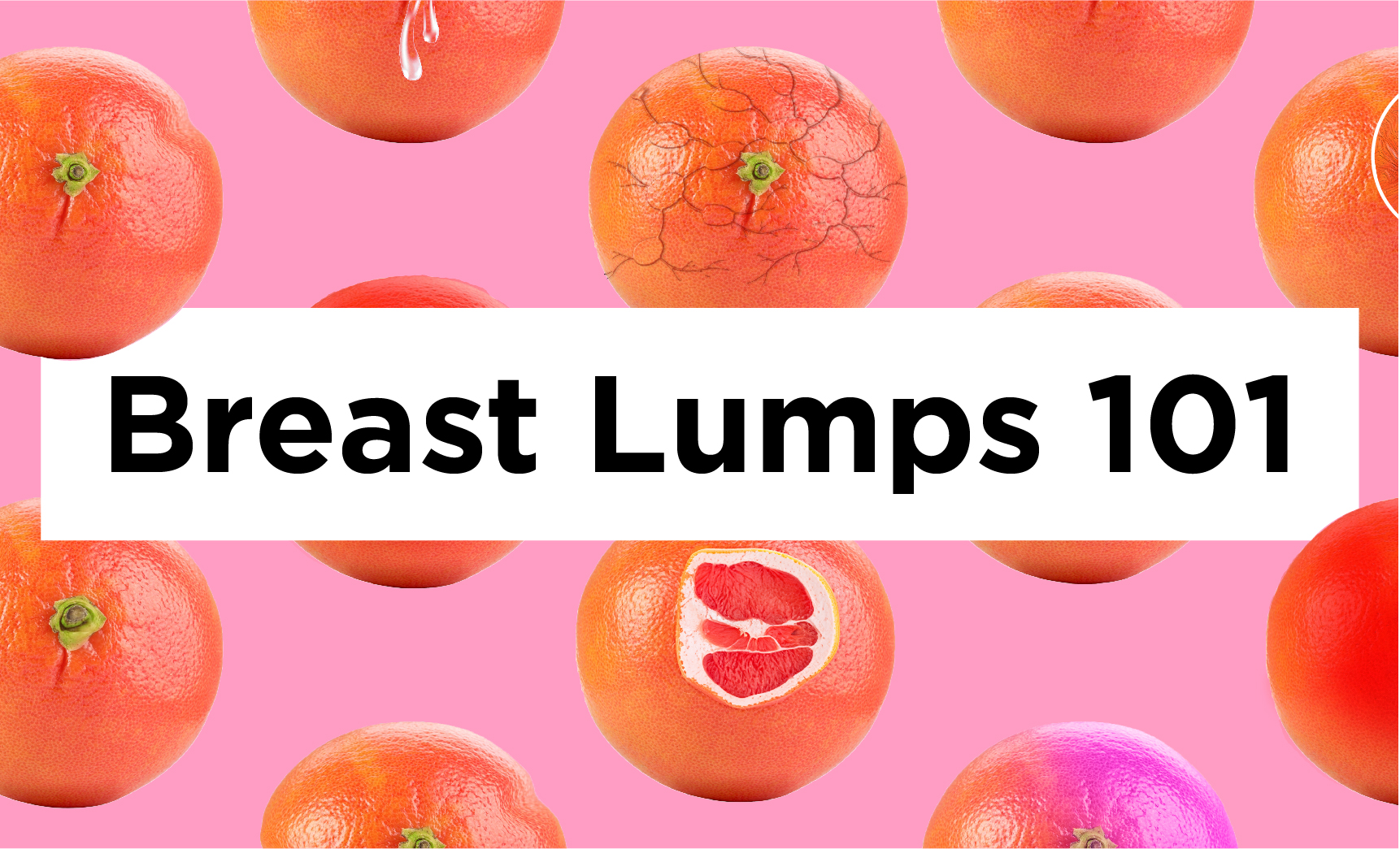 Is My Breast Lump Cancerous? A Guide to Breast Lumps