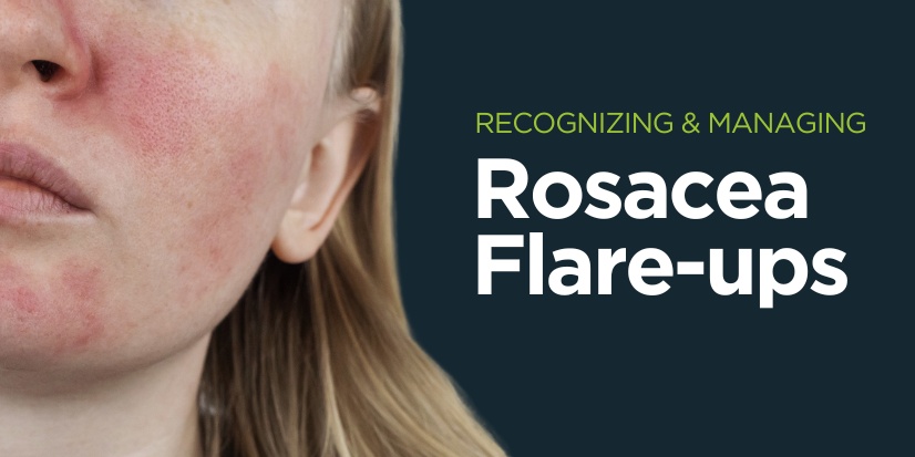 A Self Care Guide for Rosacea with Matt Francom, PA-C - Healthy You