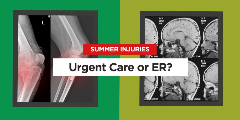 Urgent Care or ER: Summer Injuries Edition | Ogden Clinic
